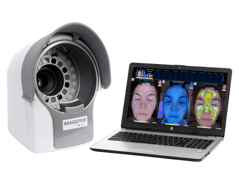 Skin Imaging Systems & Skin Analysis Cameras | Emage